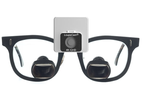 LoupeCam - HD Cameras for Loupes & Headlights